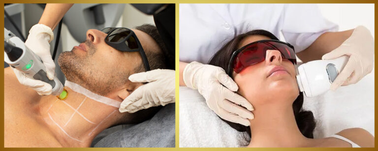 Laser Hair Reduction Treatment in Chennai