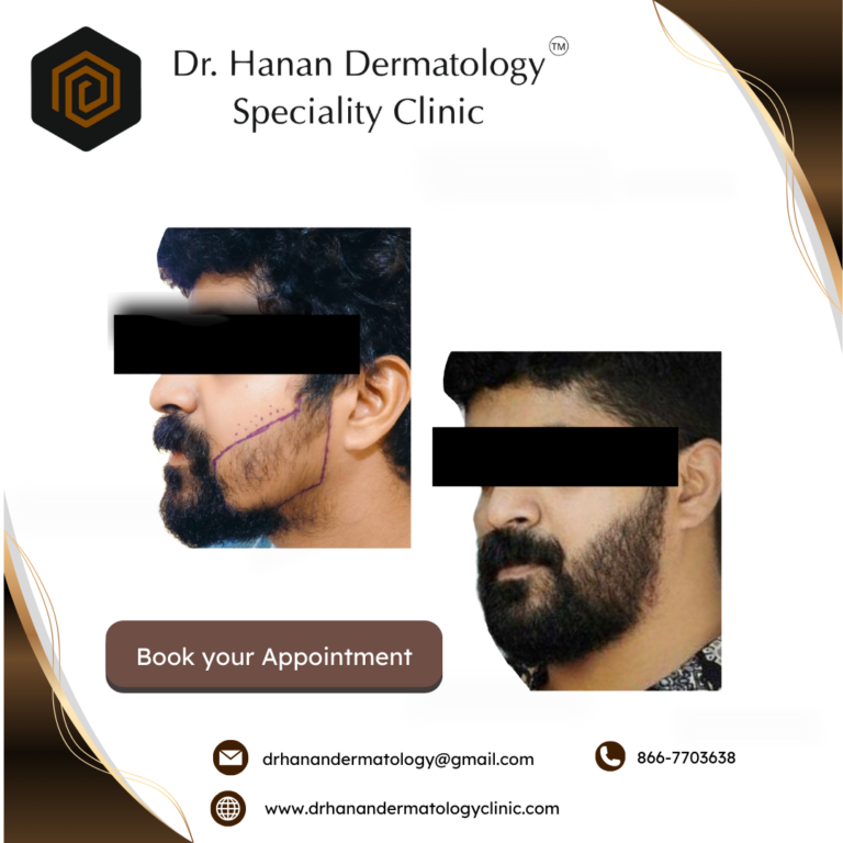 Gallery - Dr. Hanan Dermatology Speciality Clinic
